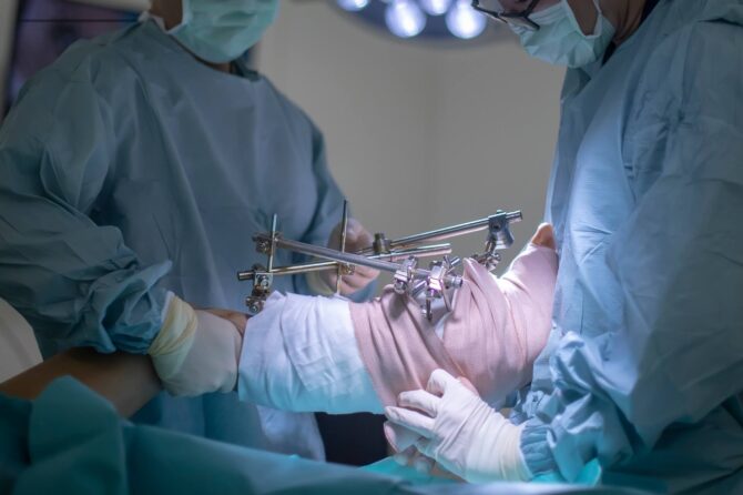 Bone Specialist Near Me in Hyderabad | Dr. B Vivekananda